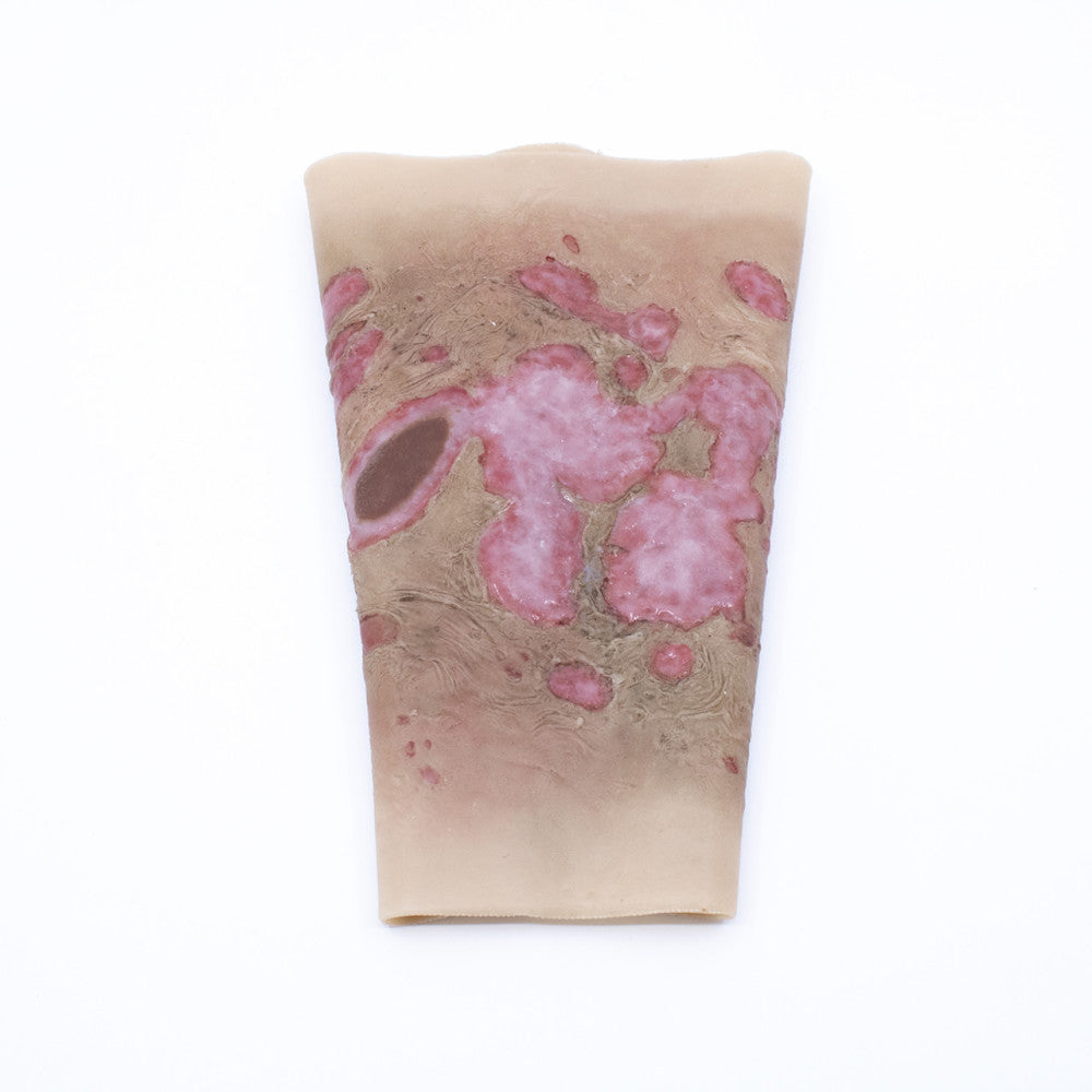 TRAUMASIM Wearable Large Burn - Forearm – promedsupplies.com.au